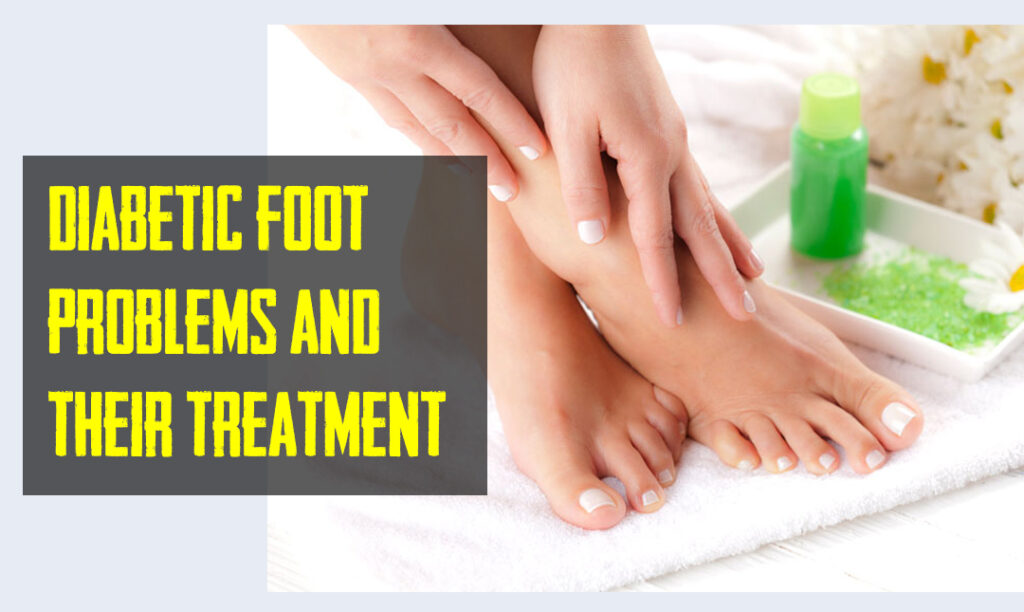 Common Diabetic Foot Problems And Their Treatment